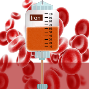 Iron IV Infusion – Sina Health Centre